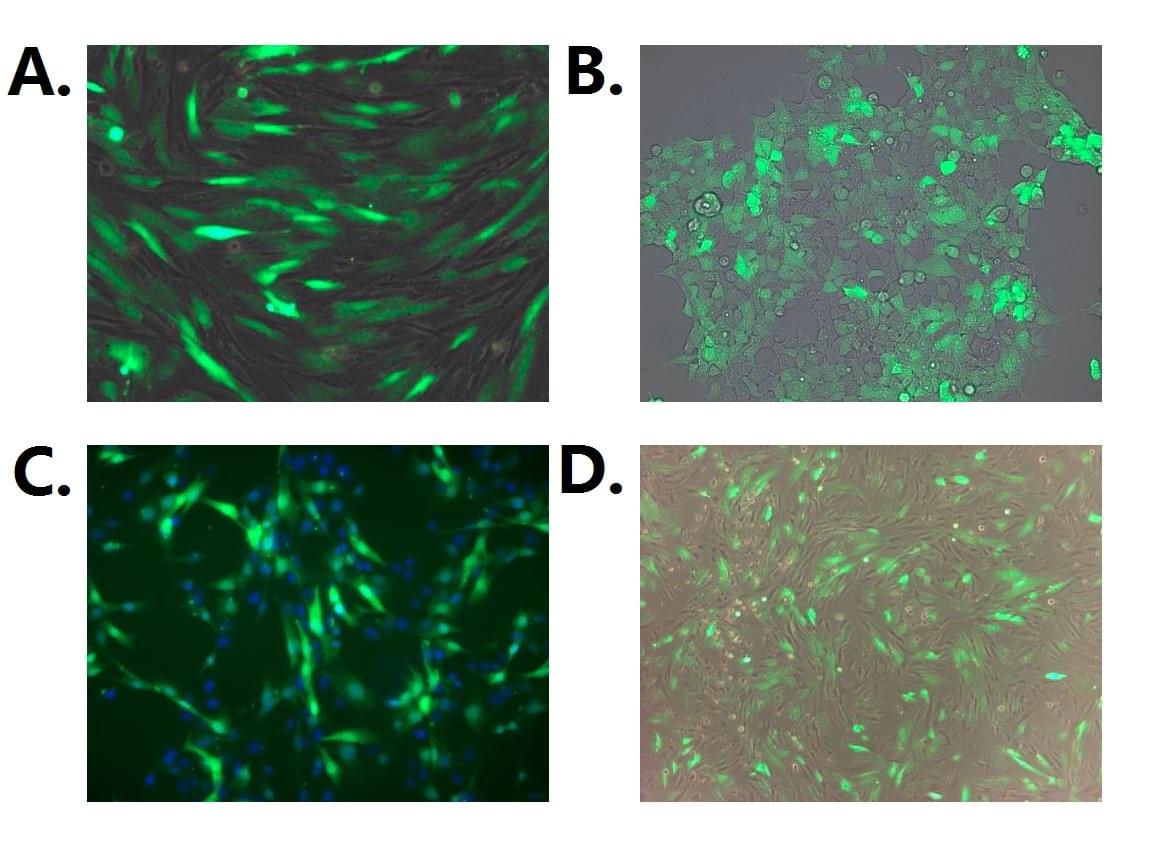 Magic™ mRNA转染试剂 - 安必奇生物